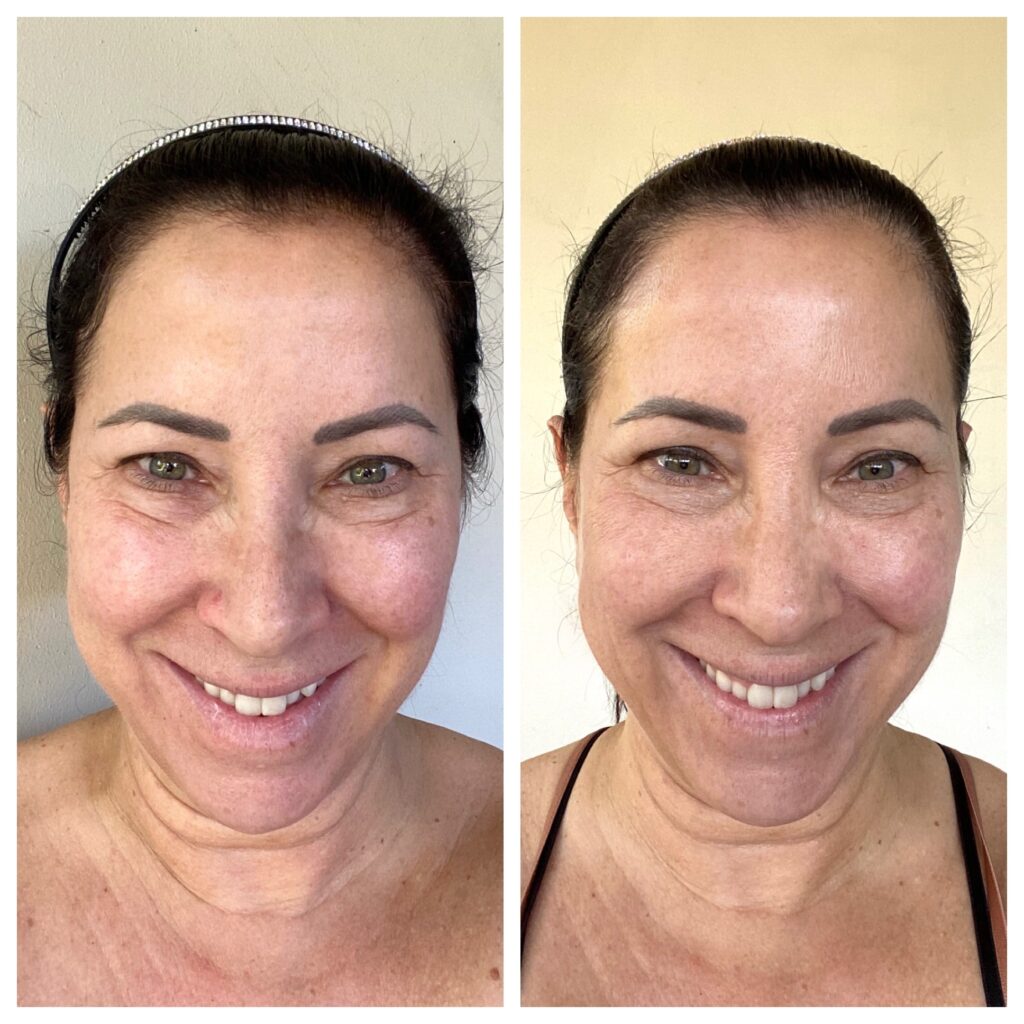 Redefine Regimen from Rodan and Fields {Review} - Romy Raves